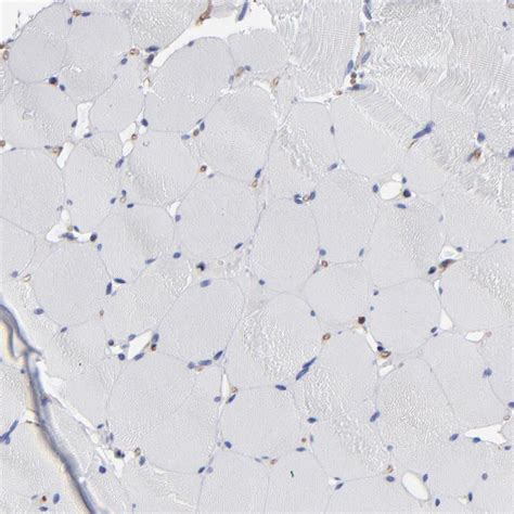 Anti Tm4sf1 Human Protein Atlas Antibody