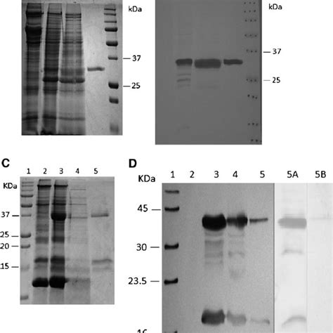 Pdf Use Of Strep Tag Ii For Rapid Detection And Purification Of Mycobacterium Tuberculosis