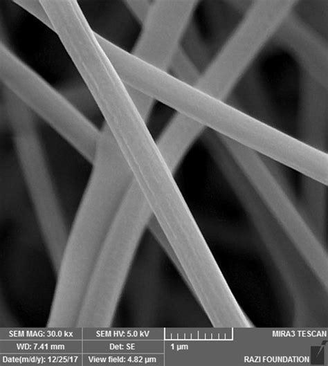 Sem Micrograph Of The Electrospun Acyclovir Nanofibers Electrospinning Download Scientific