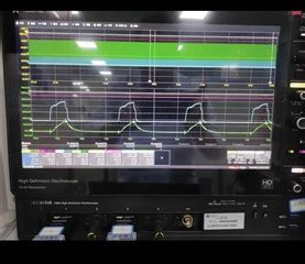 LM3478Q Q1 LM3478 Q1 Power Management Forum Power Management TI