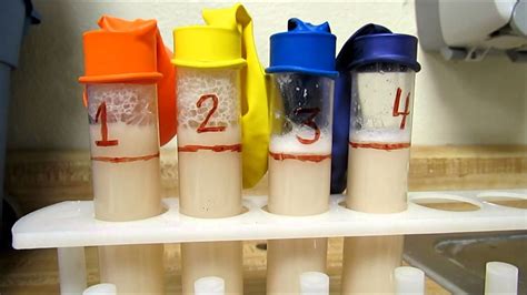 Yeast Assignment Point