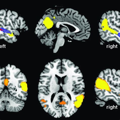 A Comparison Between Statistical Dependence Measured With Standard Download Scientific Diagram