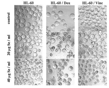 Morphology Of Hl 60 Hl 60 Dox And Hl 60 Vinc Cells After 72 H Of