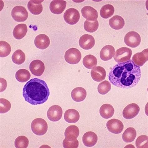 Book Giemsa Stain Test Price In Delhi Cost Near Me India Ganesh