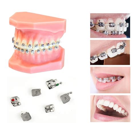 Brackets Roth Mini Poladent