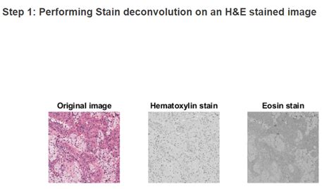 GitHub Imabhi Stain Density Estimation Stain Deconvolution Results In Separating The