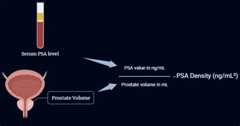 Prostate Volume Calculator And Psa Density Calculator