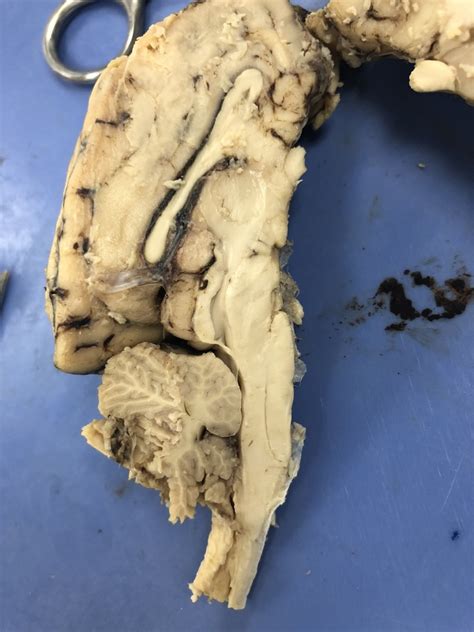 Sheep Brain Diagram Quizlet