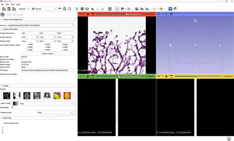 Support For Pathology Dicom Development 3d Slicer Community