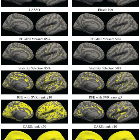 Relevant Feature Maps For Different Mvpa Methods Detected On The Oasis