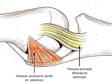 Entorse Du Pouce Traumatisme Des Doigts De La Main Pr Eric Roulot