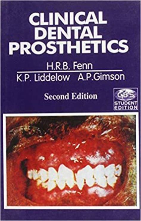 Clinical Dental Prosthetics 2ed Pb 2008 Paperback Buy Clinical Dental Prosthetics 2ed Pb