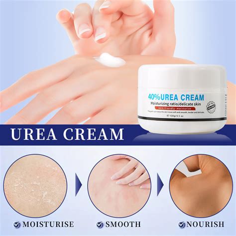 40 Urea Cream Specifically For Hyperkeratosis Ichthyosis Psoriasi Yingtide