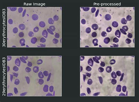 Image Before And After Pre Processing Download Scientific Diagram