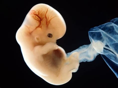 Formación Awaking Project