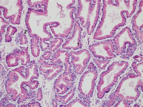 Próstata Atlas De Histologia Veterinária