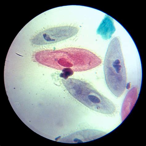 Paramecium Under Microscope Biology Notes Online Paramecium Under Microscope Biology Notes Online