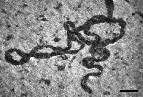 Any Idea What This Is Worm Fossil ID The Fossil Forum