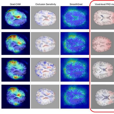 Traditional Interpretability Methods Left To Right Grad Cam Occlusion