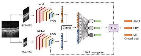 Multi Scale Learning With Sparse Residual Network For Explainable Multi Disease Diagnosis In Oct