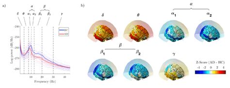 Spectral Analysis Of Meg Signals A Power Spectrum Density Psd For A