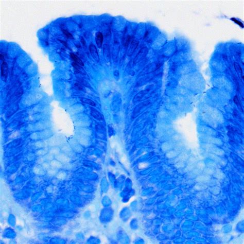 Helicobacter Pylori Doccheck