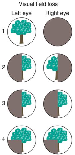 Visual System Flashcards Quizlet