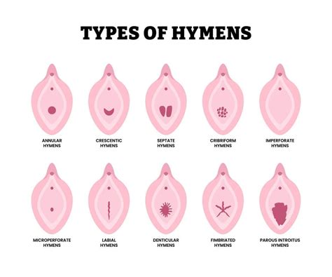 Different Types Of Hymen Shape Types Labeled Annular Crescentic