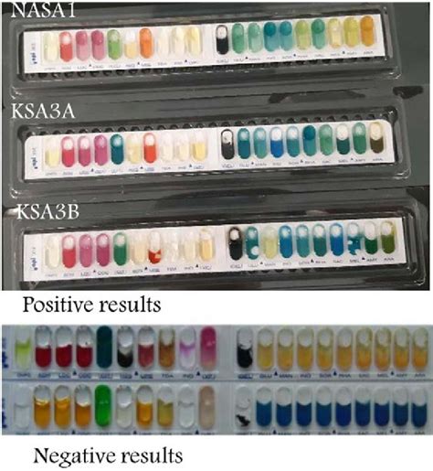 Results Of The Api 20 Ne Kit For The Three Bacterial Isolates Positive Download Scientific