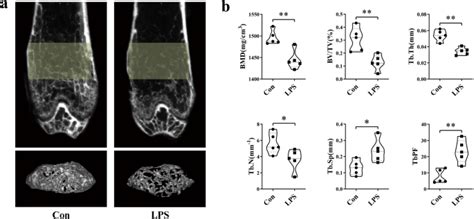 Lps诱导的骨丢失小鼠循环外泌体抑制成骨细胞分化 Calcified Tissue International X Mol