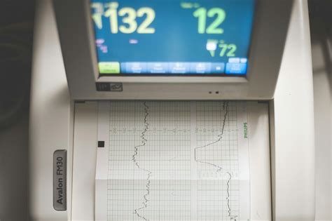 Angiogram Procedure Benefits And Risks Explained