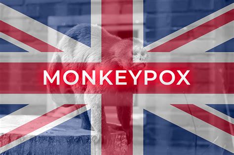 Monkeypox Uk Illustration Tetiana Strilchuk Via Istockphoto Metro