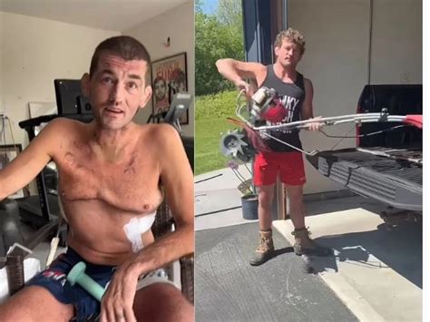 Ben Askren Reveals Long Recovery After Double Lung Transplant And
