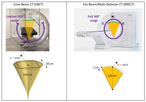 Cone Beam Ct Meaning The Best Picture Of Beam