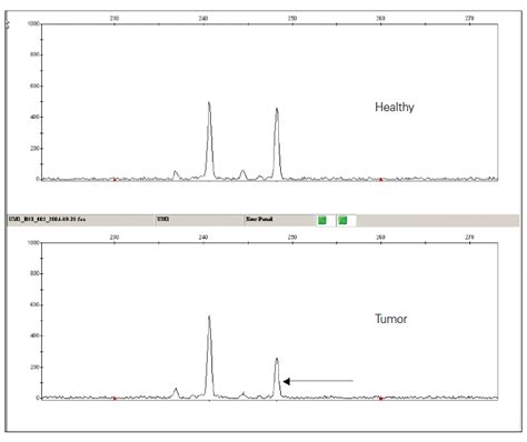 Quantitative Fluorescence Pcr Qf Pcr Thermo Fisher Scientific Uk