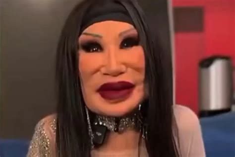 Lyn May Sorprende A Todos Por El Tamaño De Su Rostro ¿qué Le Pasó