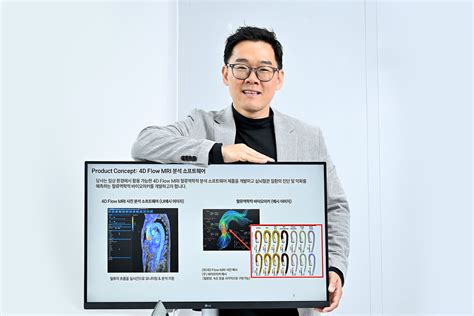 2024 강원춘천 강소연구개발특구 기업 Ceo Mri 의료영상 기반 심혈관 질환 환자의 비정상 혈류 자동분석 Sw 개발한 플로우닉스 │ 매거진한경