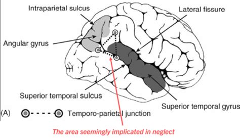 W6 8 Attention Executive Function Adhd Flashcards Quizlet