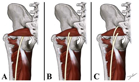 Sciatic Nerve Distribution