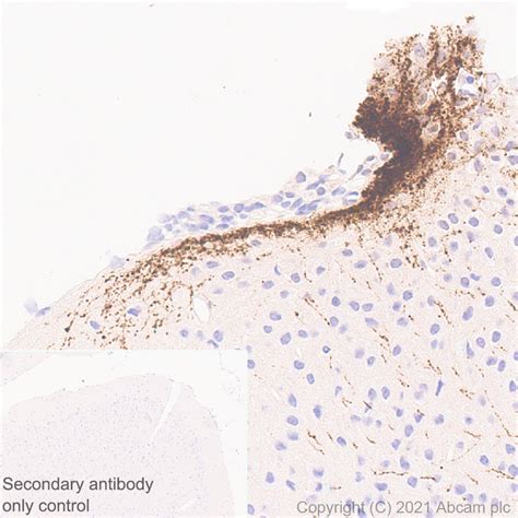 Anti Gnrh Antibody Epr24529 70 Ab281844 Abcam