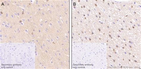 Anti Tau Mtbr Tau243 Antibody Epr29541 59 Ab322554 Abcam