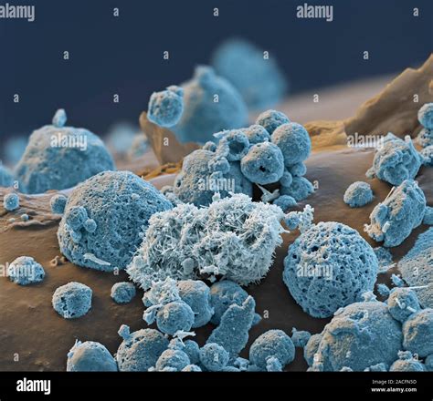 Lithium Ion Crystals Blue Coloured Scanning Electron Microscope Sem