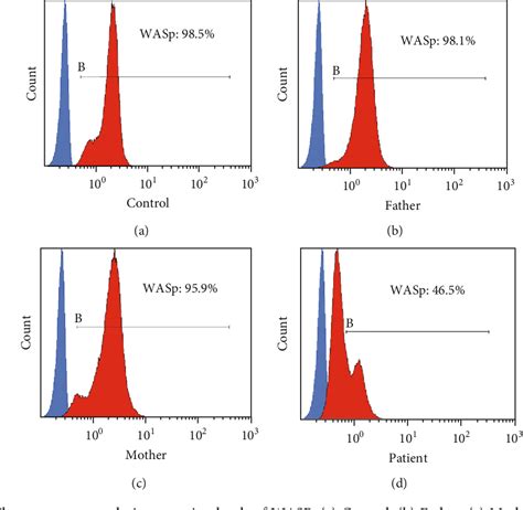 Figure 4 From A Novel Splicing Mutation Leading To Wiskott Aldrich