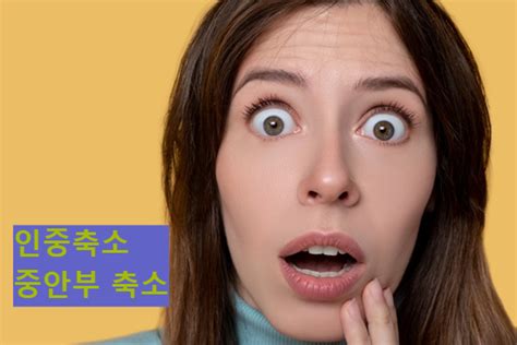 얼굴은 별로 길지 않은데 중안부가 길다는 느낌을 받아왔었습니다 돌출입에 부정교합까지 있어서 더욱 그렇게 느껴졌던 것 같습니다 인중길이는 17mm정도 됩니다 중안부