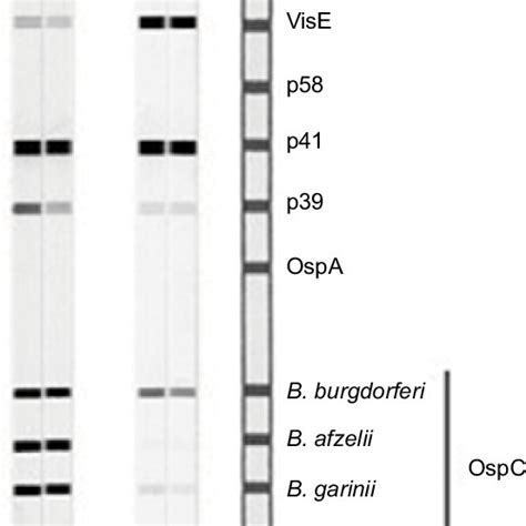 Anti Borrelia Antibodies Detected By Recomline Borrelia Igg And Igm