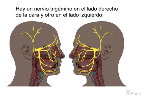 La Neuralgia Del Trigémino