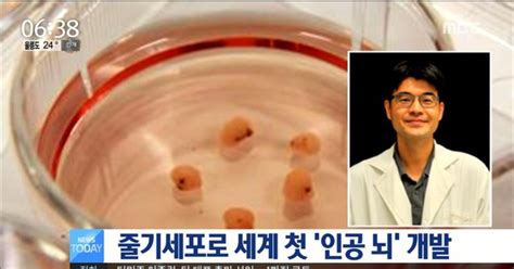 줄기세포로 세계 첫 미니 인공 뇌 개발