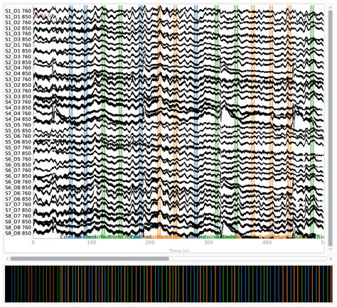 Preprocessing Functional Near Infrared Spectroscopy Fnirs Data — Mne 1 0 3 Documentation