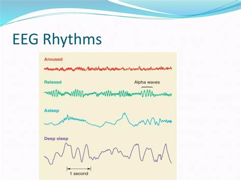 Electroencephalography Eeg Pptx