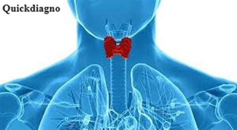 Tft Thyroid Function Test Quickdiagno Diagnostic And Dental